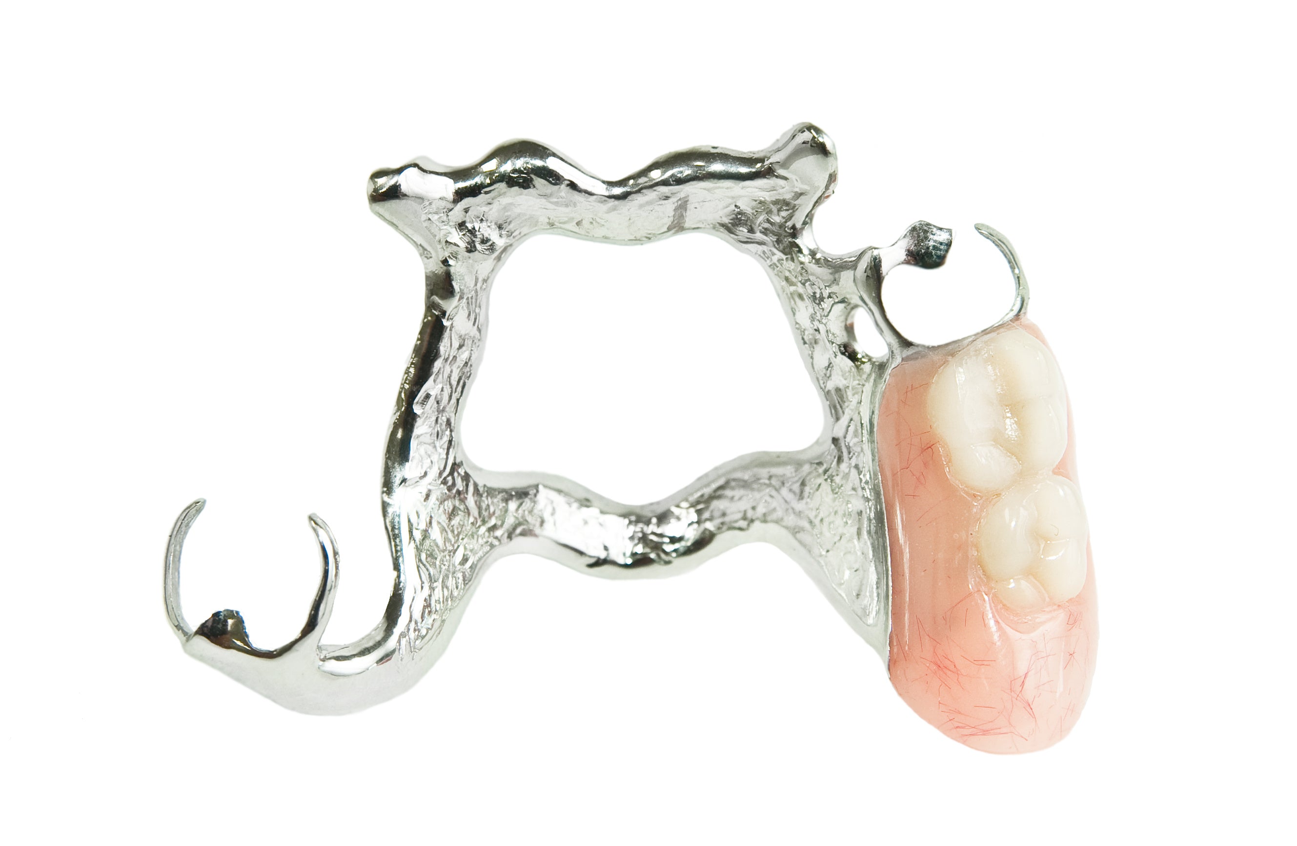 Partial Metal Frame – Creative Dental Industries