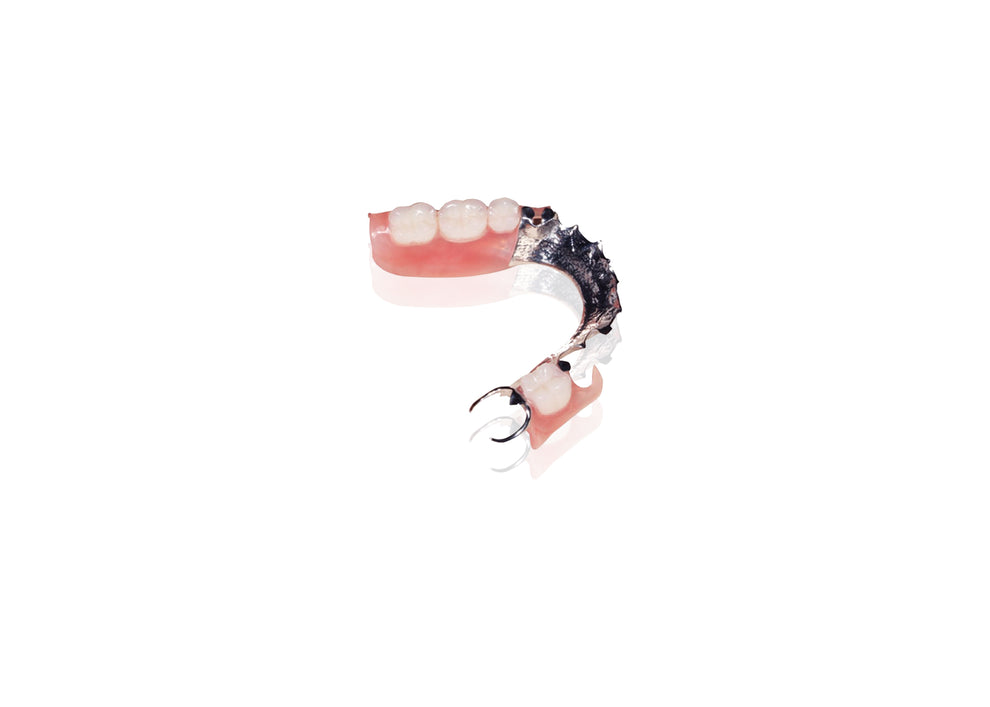 Valplast with Metal Frame – Creative Dental Industries